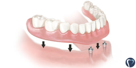 Gebitspraktijk Dordrecht | Diensten
